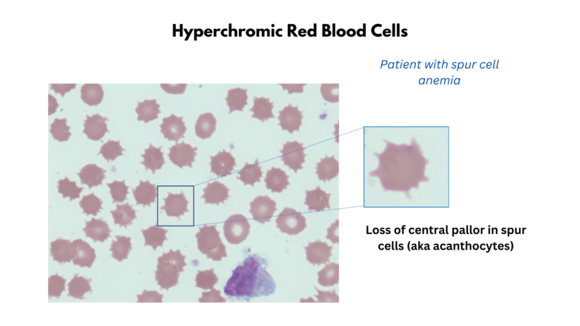 Red Cell Staining (Color) • The Blood Project