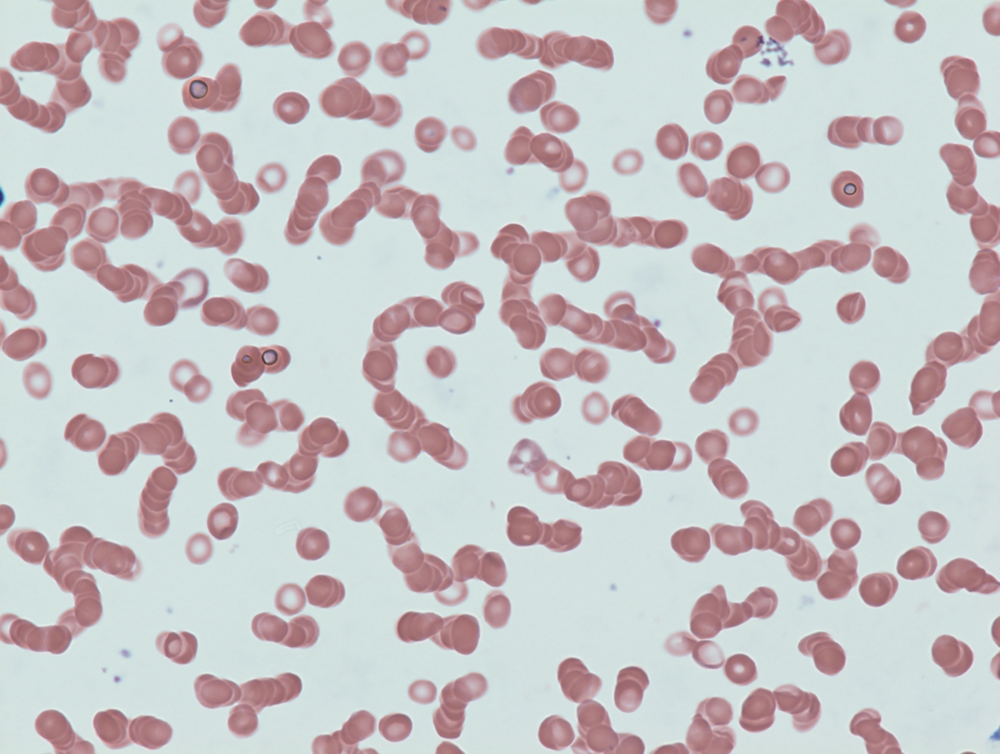 Overview • The Blood Project