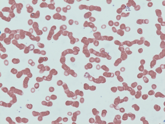 Overview • The Blood Project