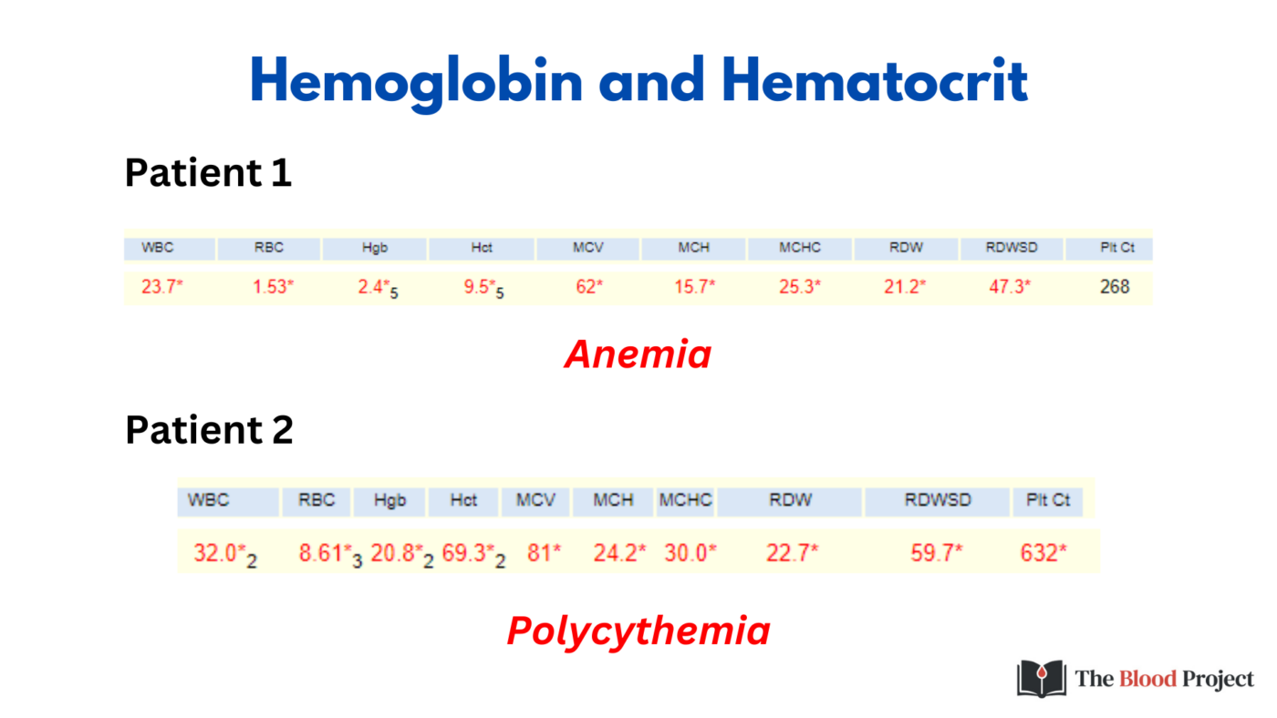 Hb and Hct • The Blood Project