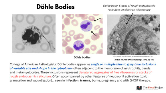 Döhle Bodies • The Blood Project