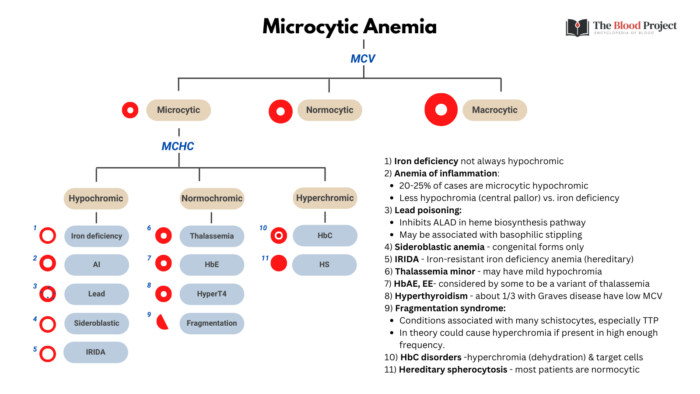Classification of Microcytic Anemia • The Blood Project