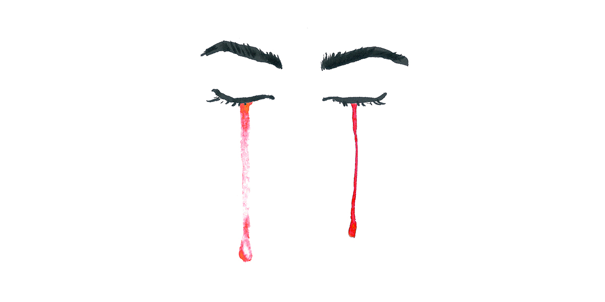 Leukoerythroblastic Picture vs. Myelophthisis • The Blood Project