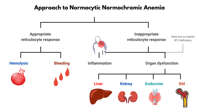 Classification of Normocytic Anemia • The Blood Project