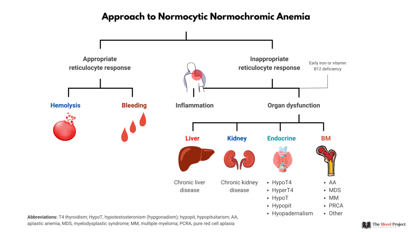 Classification of Normocytic Anemia • The Blood Project