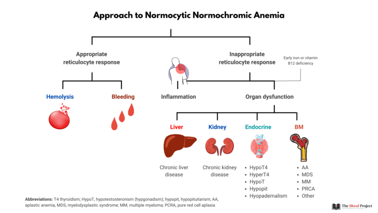 Classification of Normocytic Anemia • The Blood Project