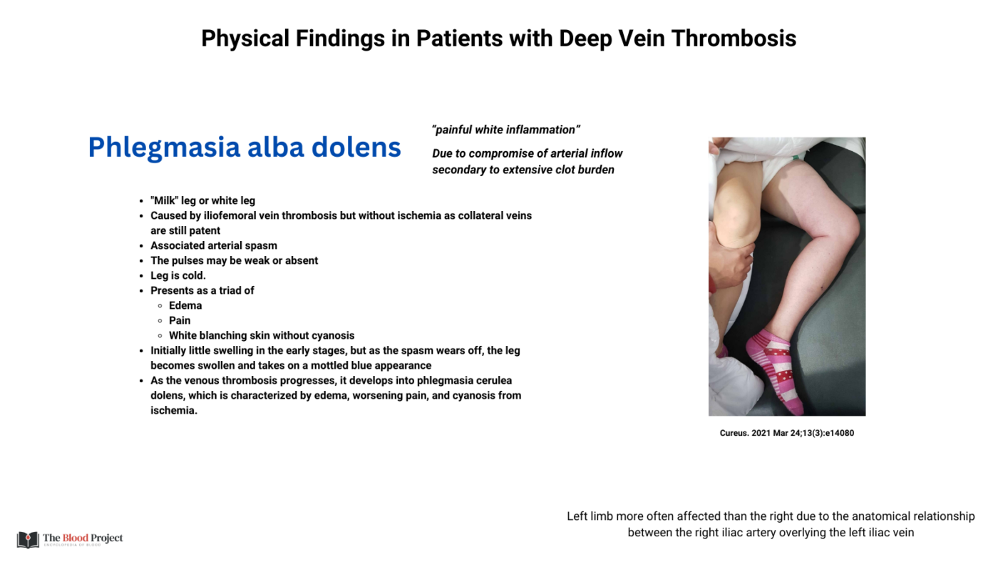 Physical Findings in Patients with DVT • The Blood Project