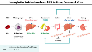 Urobilinogen in Hemolytic Anemia • The Blood Project