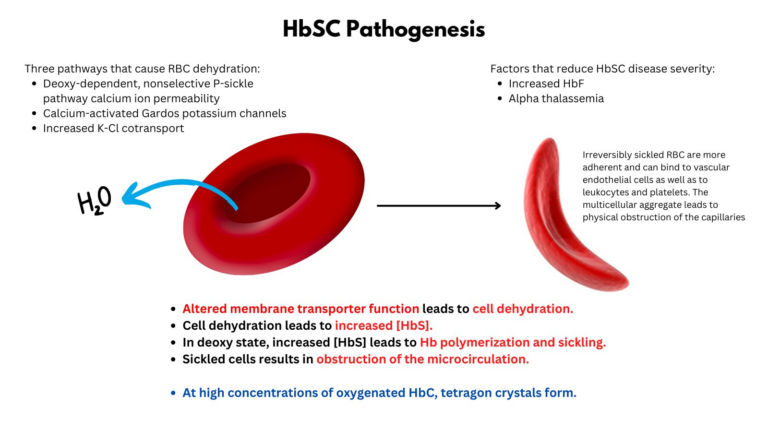 HbSC Disease • The Blood Project