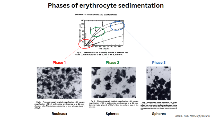 ESR • The Blood Project