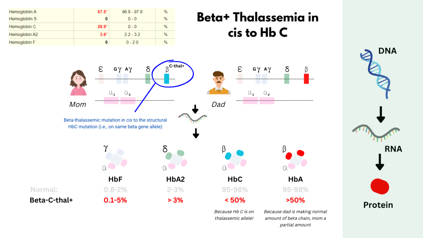 Answer to Hb Electrophoresis • The Blood Project