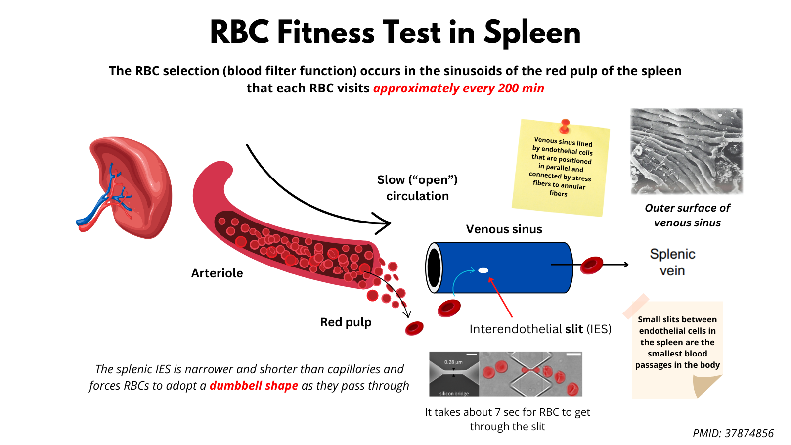 The Splenic Challenge • The Blood Project