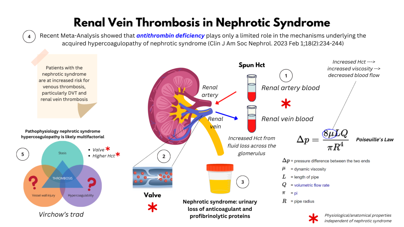 Renal Vein Thrombosis • The Blood Project