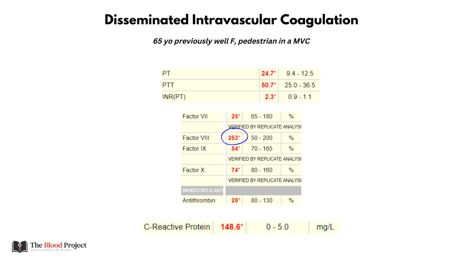 DIC or Liver Disease? • The Blood Project