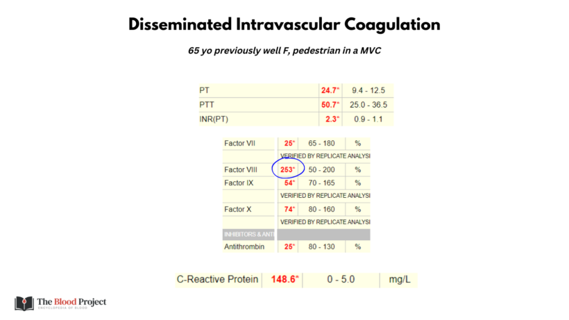 DIC or Liver Disease? • The Blood Project