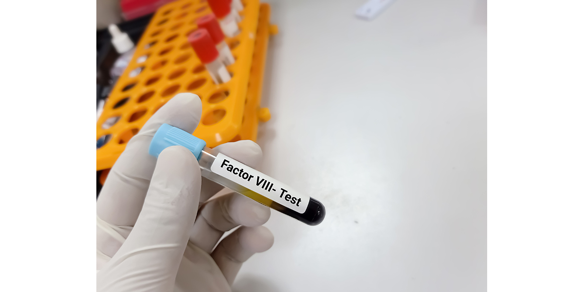 DIC or Liver Disease? • The Blood Project