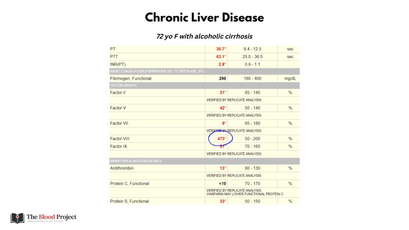 DIC or Liver Disease? • The Blood Project
