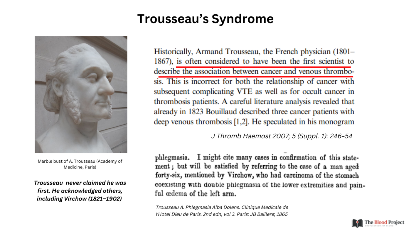 Eponyms in Hematology – Trousseau's Syndrome • The Blood Project