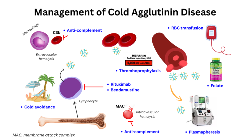 Management of Cold Agglutinin Disease • The Blood Project