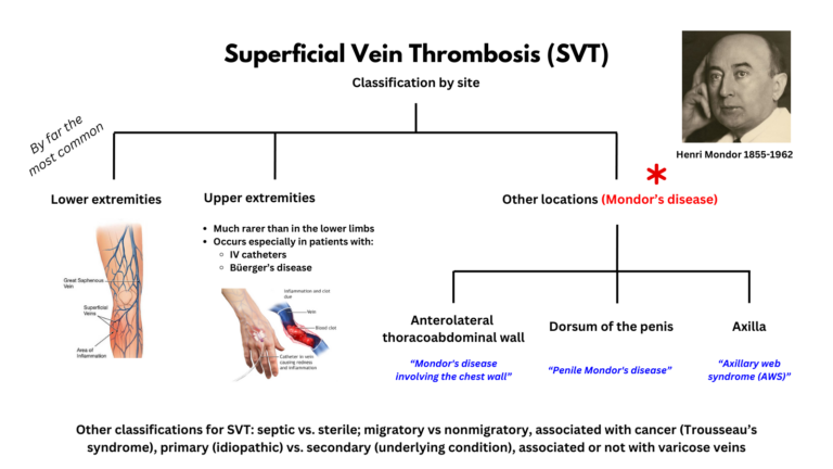 Mondor's Disease • The Blood Project
