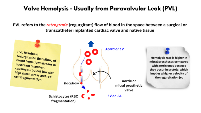 Valve Hemolysis • The Blood Project