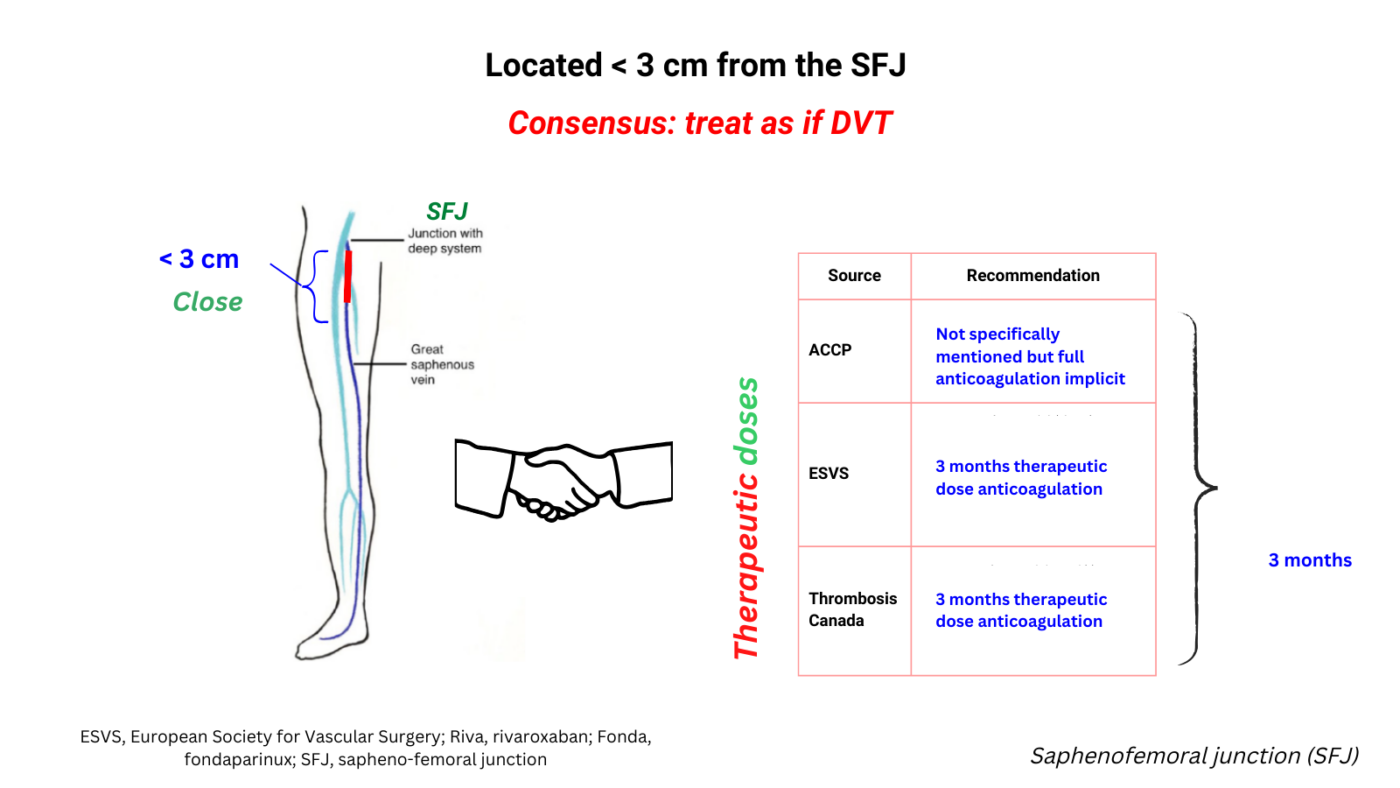 Superficial Vein Thrombosis: To Anticoagulate or not to Anticoagulate ...