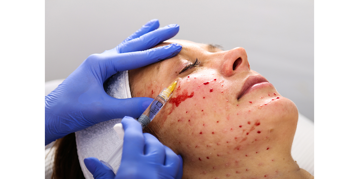 Blood as a Historical Anti-Aging Component and Contemporary Skin Care's ...