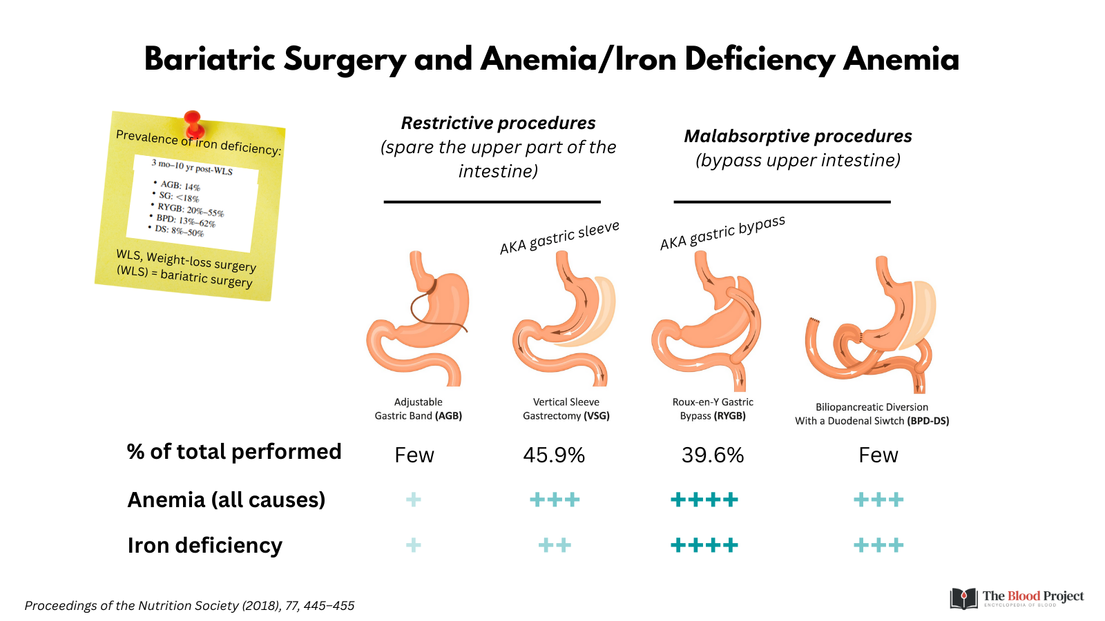 Iron Deficiency in Bariatric Surgery • The Blood Project