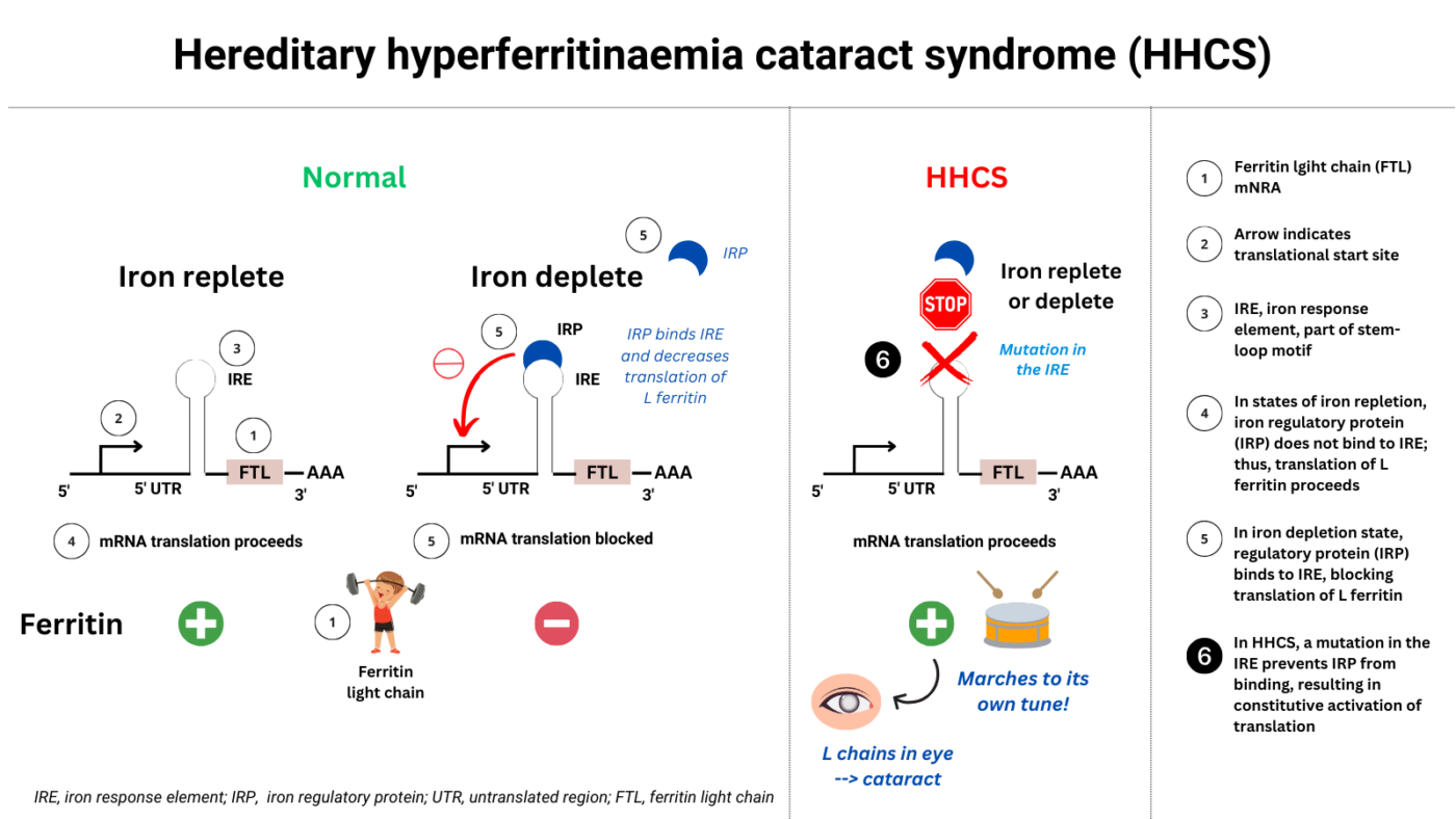 Case of Hyperferritinemia • The Blood Project