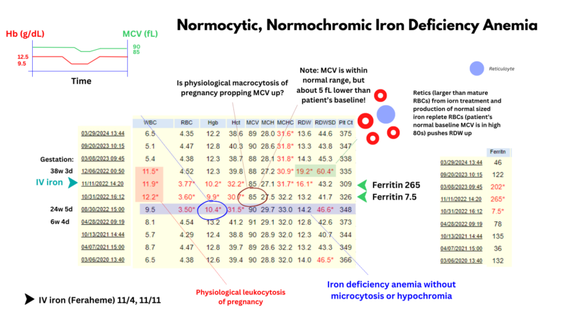 Normocytic Normochromic IDA • The Blood Project