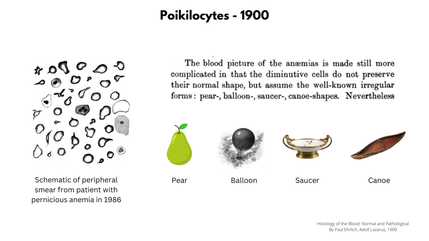 Metaphorical Representation of Poikilocytes • The Blood Project