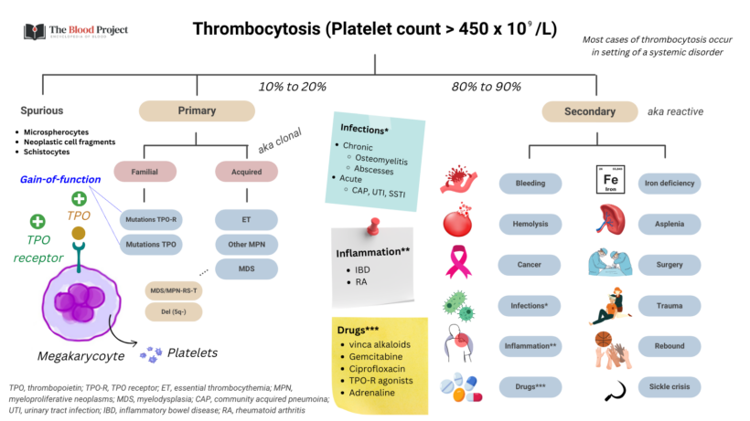 Classification of Thrombocytosis • The Blood Project