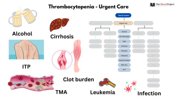 Classification of Thrombocytopenia • The Blood Project