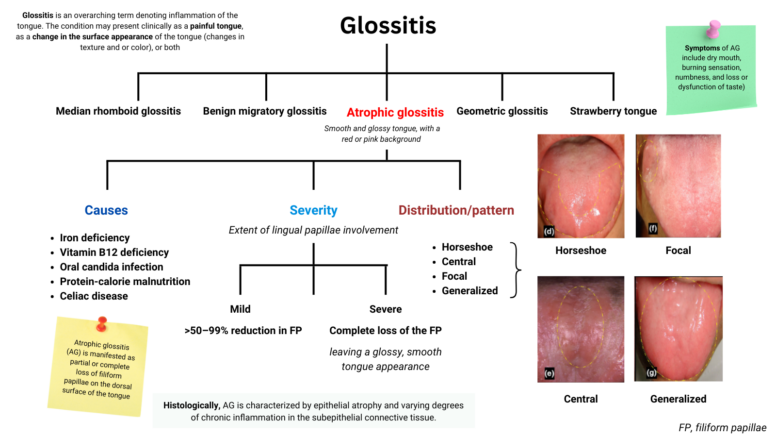 Atrophic Glossitis • The Blood Project