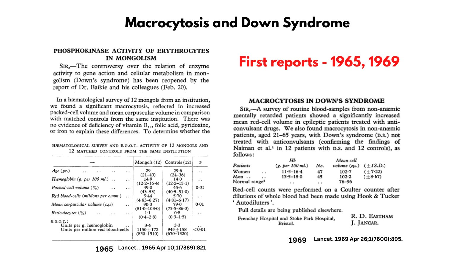 Macrocytosis of Down Syndrome • The Blood Project
