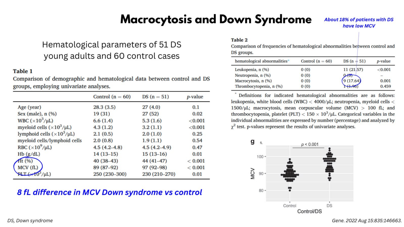Macrocytosis of Down Syndrome • The Blood Project