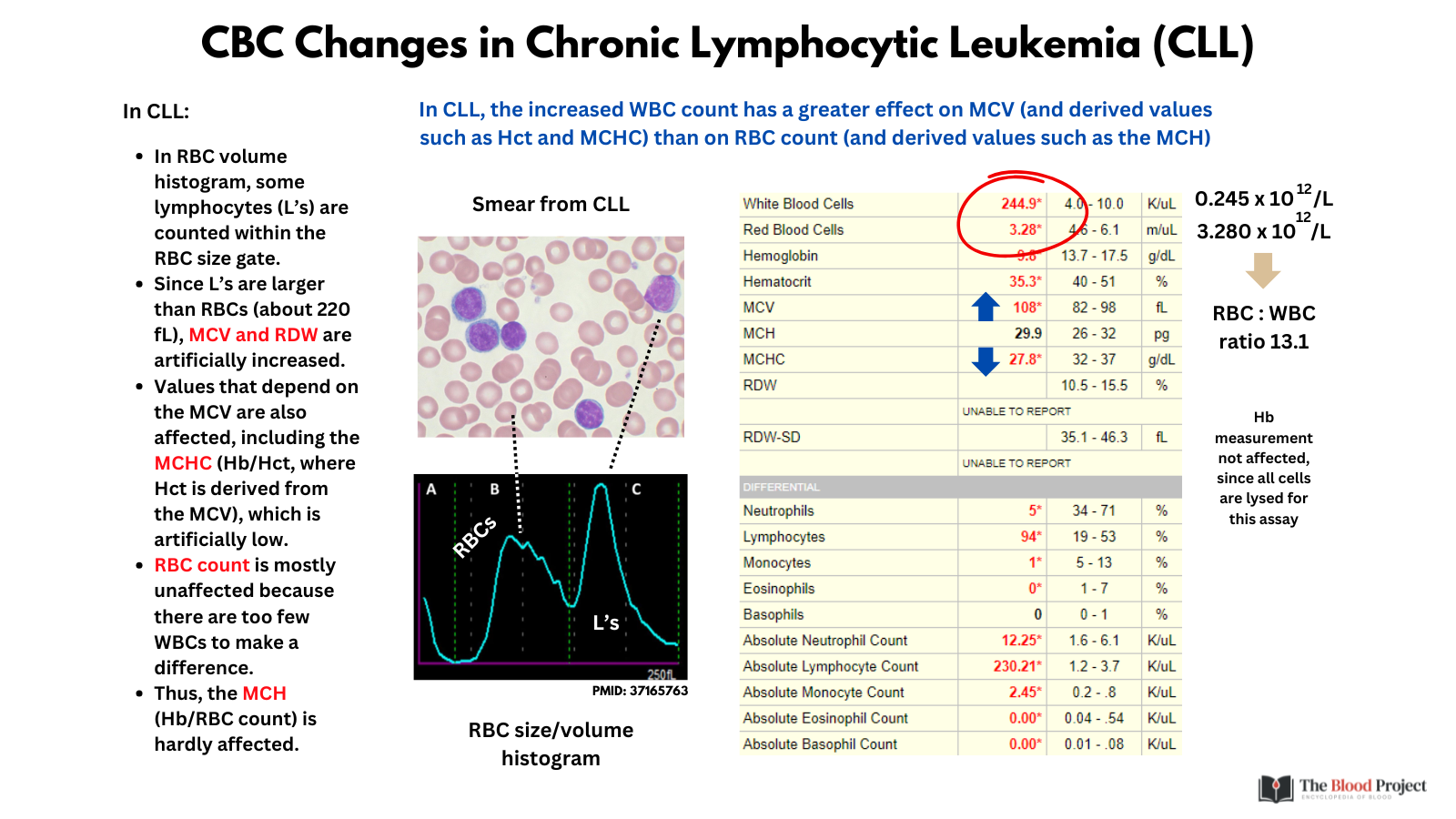 Effects of CLL on Red Cell Parameters • The Blood Project