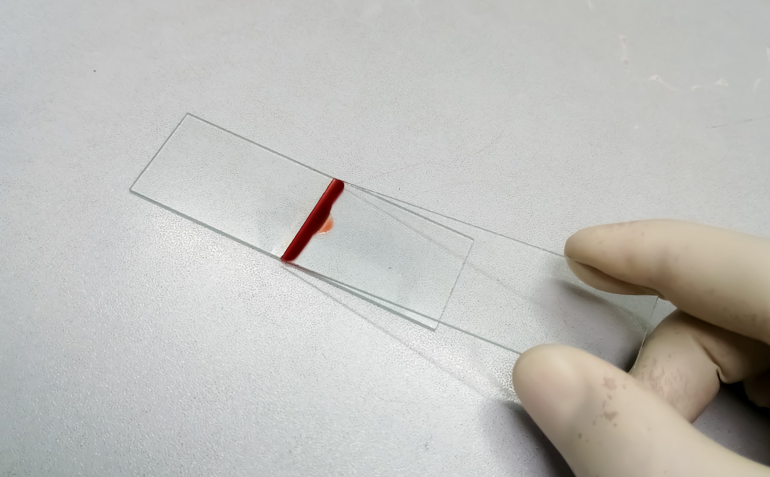 Peripheral Smears • The Blood Project