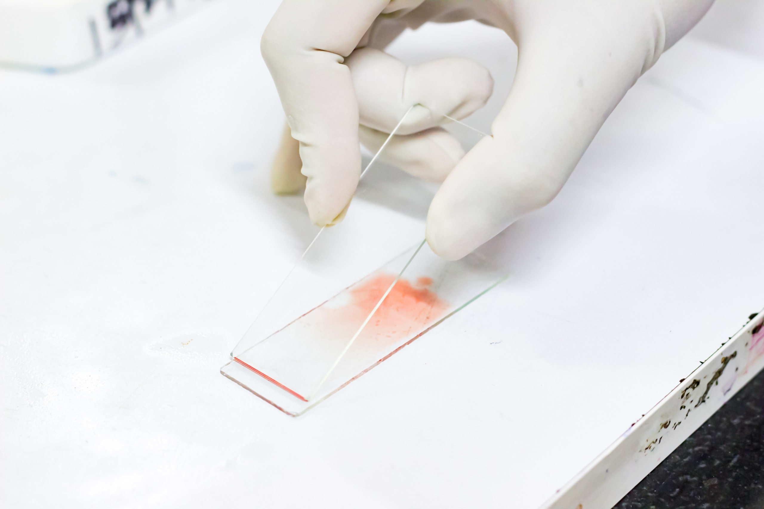 Peripheral Smears • The Blood Project