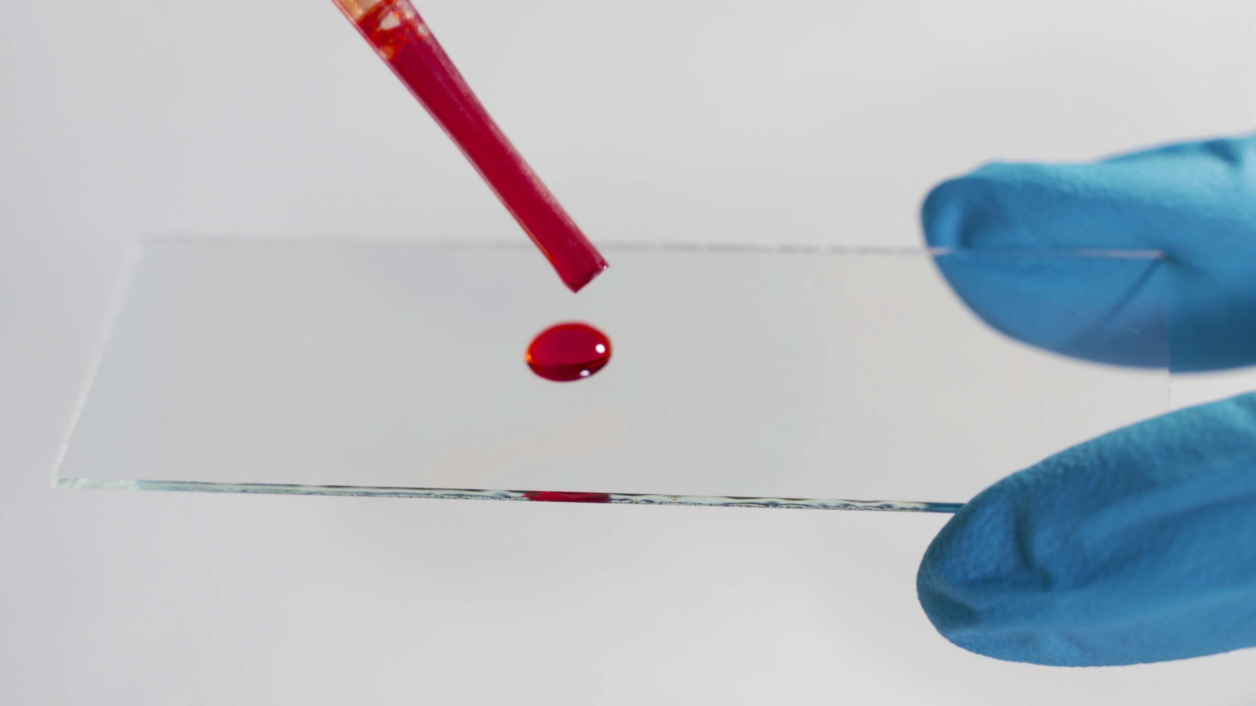 Peripheral Smears • The Blood Project