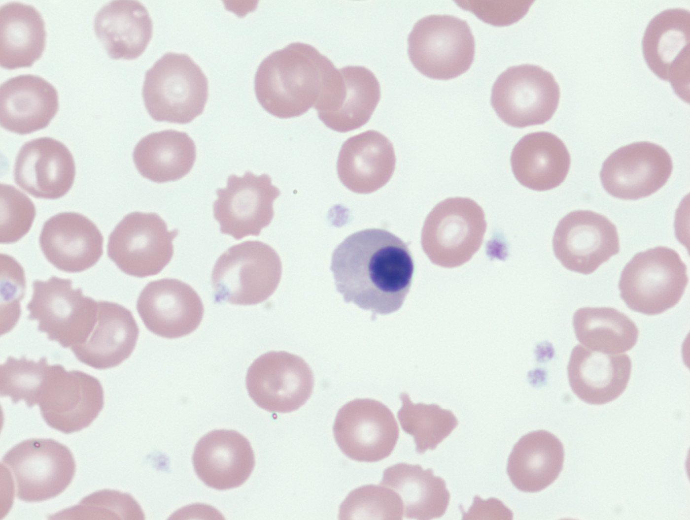 Nucleated Red Blood Cells • The Blood Project