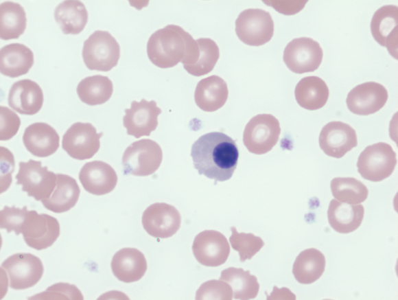 Nucleated Red Blood Cells • The Blood Project