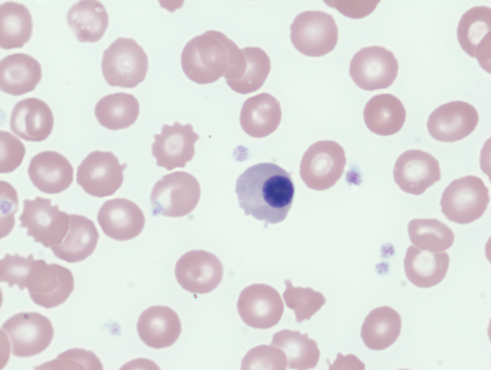 Nucleated Red Blood Cells • The Blood Project