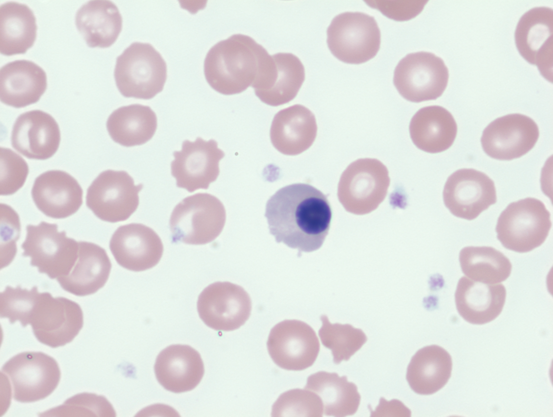 Nucleated Red Blood Cells • The Blood Project