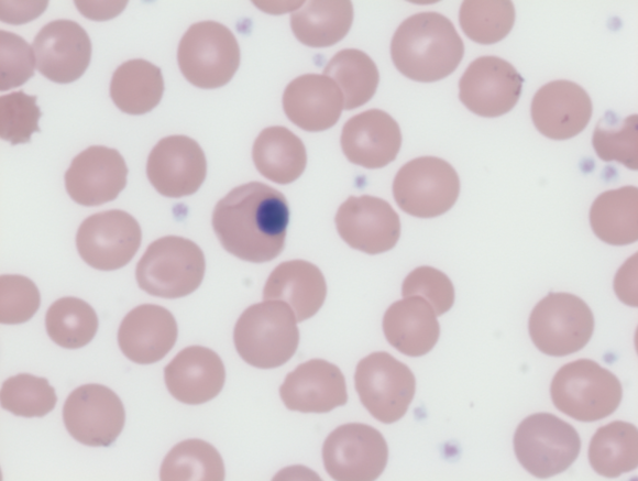 Nucleated Red Blood Cells • The Blood Project