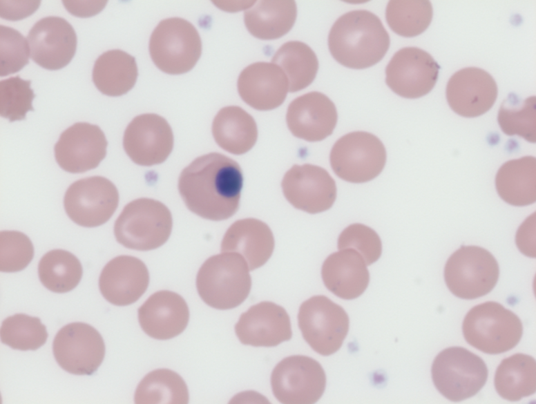 Nucleated Red Blood Cells • The Blood Project