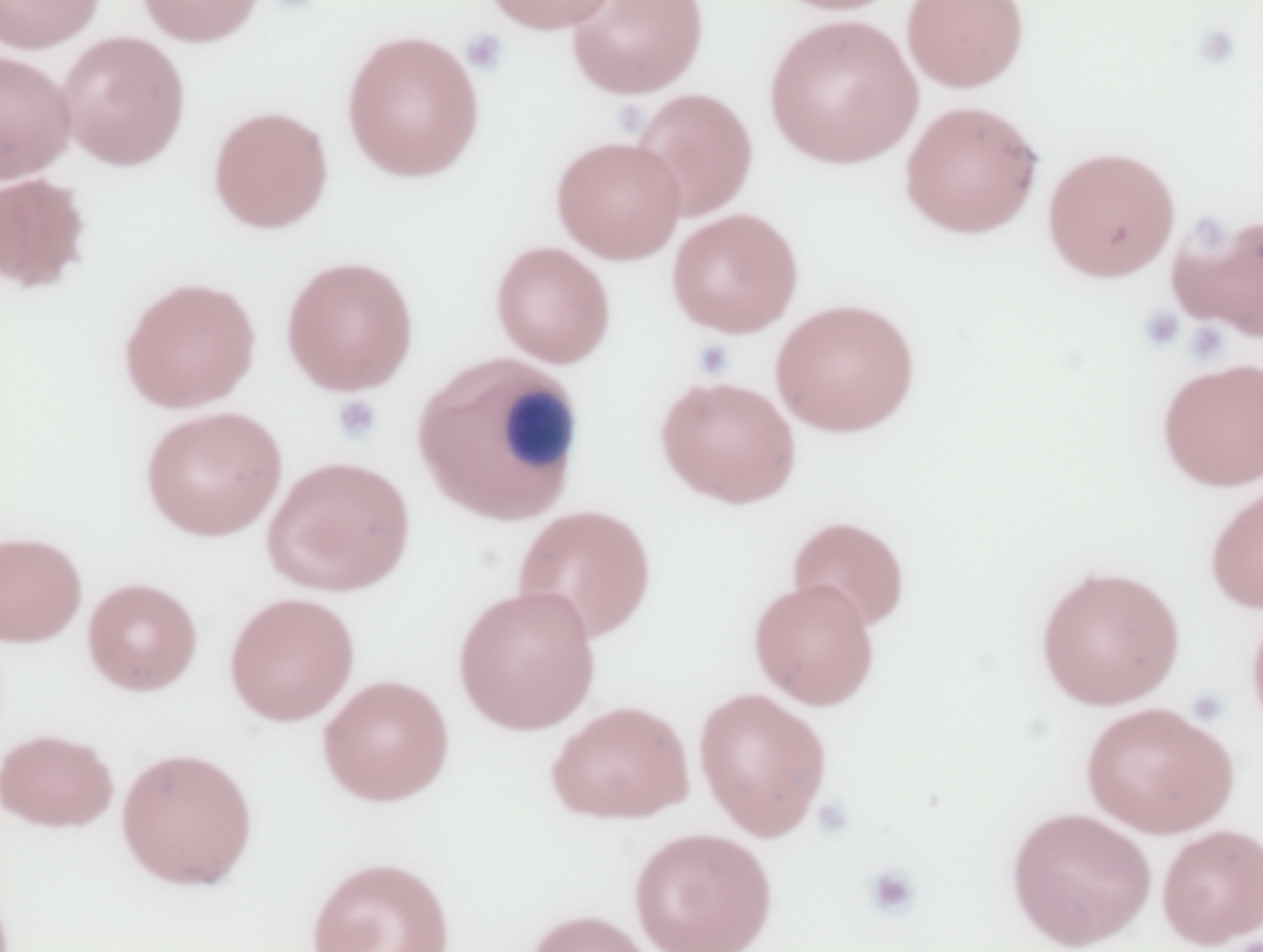 Nucleated Red Blood Cells • The Blood Project