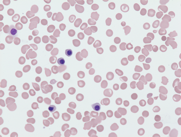 Nucleated Red Blood Cells • The Blood Project