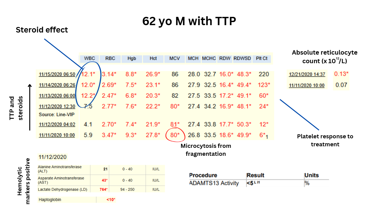 Answer to CBC Case Study on TTP • The Blood Project