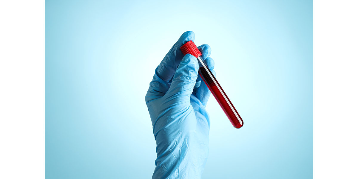 Those Bands of Burgundy and In This Cycle Nature Spun • The Blood Project